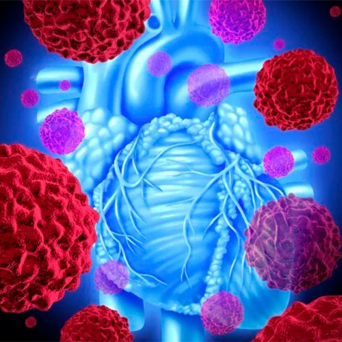 Endocardite E Febre Reumática - Portal Triple I