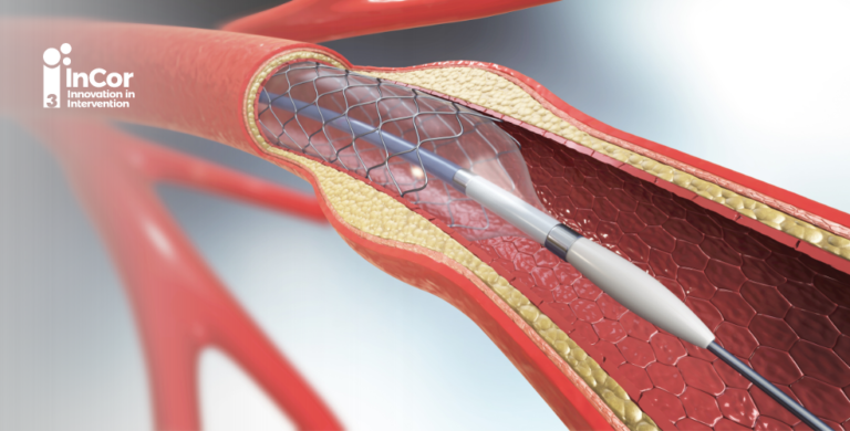 Segurança a curto e longo prazo da DAC crônica não tratada em pacientes ...